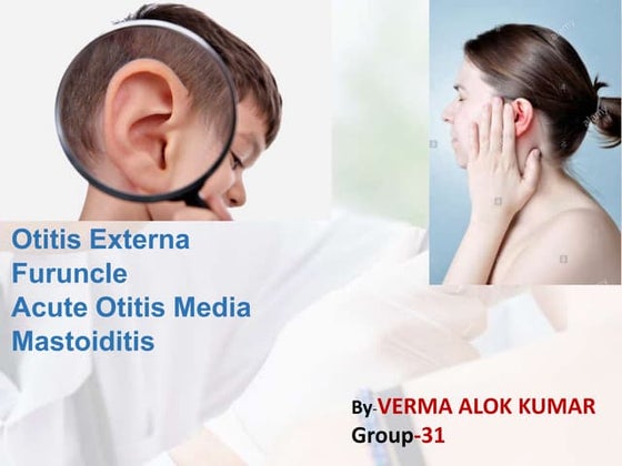 Acute Suppurative Otitis Media | PPT