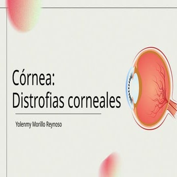 Oftalmología: distrofia corneales, tipos y tratamiento | PPTX
