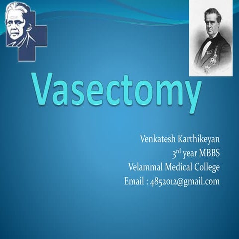 Vasectomy - Sterilization - No scalpel Vasectomy | PPTX