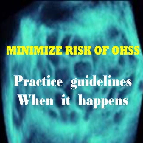 Minimizing risk of Ovarian Hyperstimulation Syndrome (OHSS): Practice ...