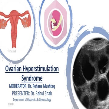 Ovarian hyperstimulation syndrome OHSS.pptx