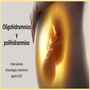 Oligohidramnios y polihidramnios | PPTX