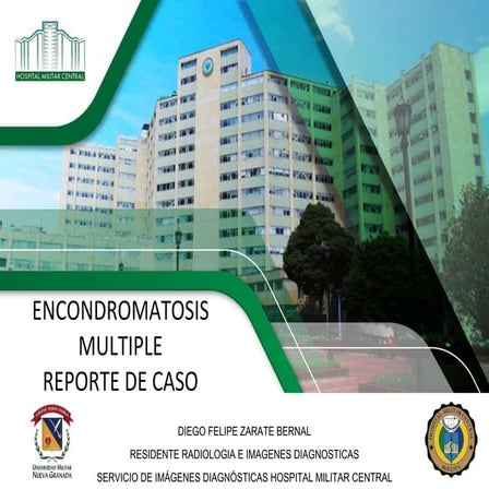 Ollier caso clinico | PPTX