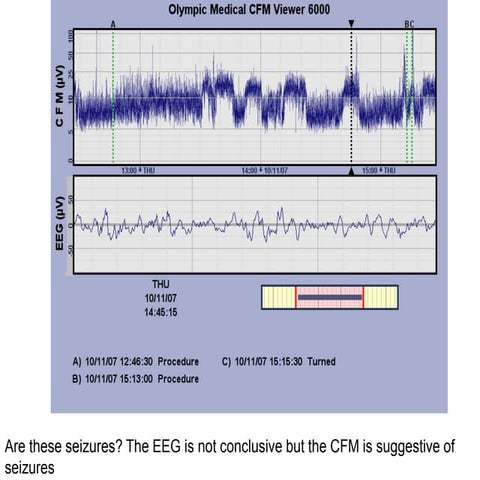 Olympic CFM cases.ppt