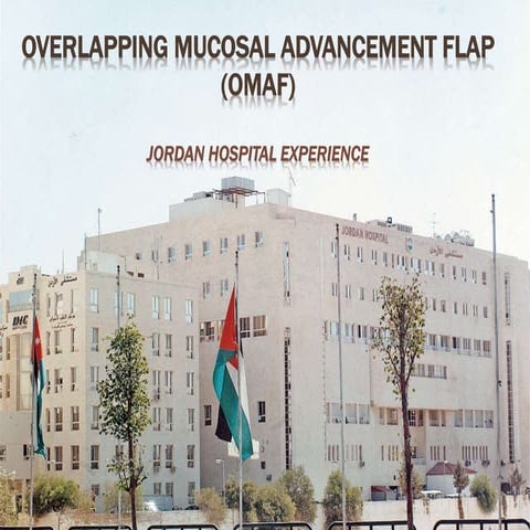 Overlapping Mucosal Advancement Flap Improves Outcome.pptx