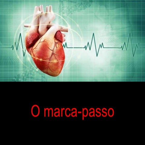 O Marca Passo.pdf