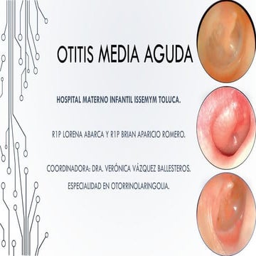 Otitis Media Aguda, diagnostico y tratamiento. | PDF