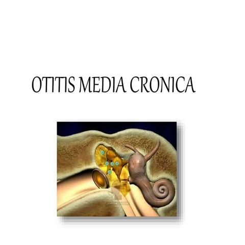 Otitis Media Crónica
