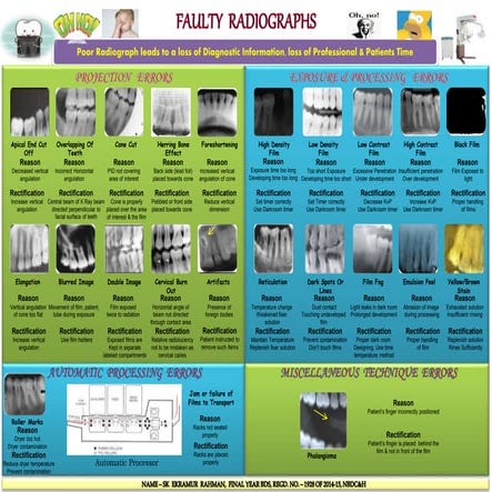 Radiographic errors and artifacts | PPTX