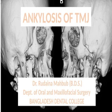 Ankylosis of TMJ Case Presentation .pptx