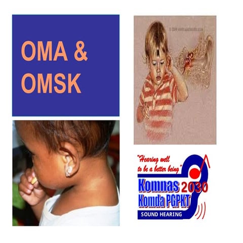 penyakit penyakit pada telinga OMSK dan OMA.ppt