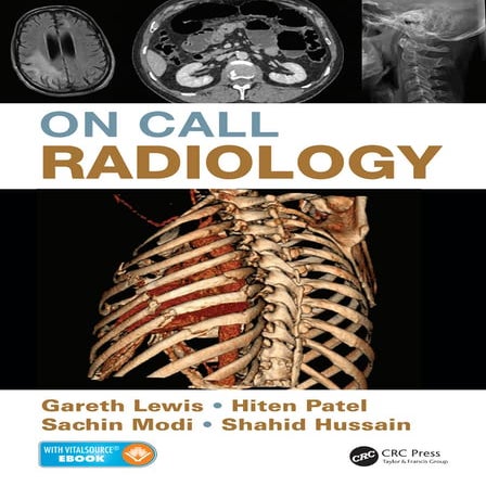On call radiology | PDF