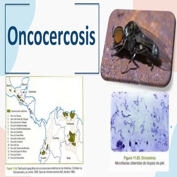 Onchocerca volvulus oncocercosis | PPTX