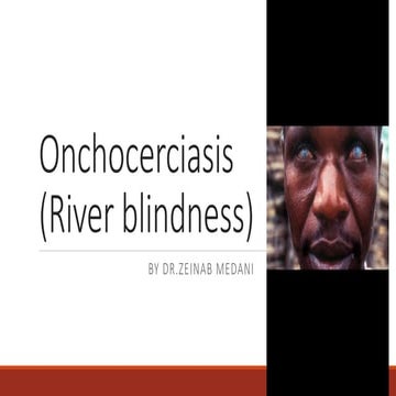 Onchocerciasis.pptx