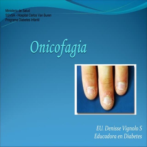 Onicofagia | PPT