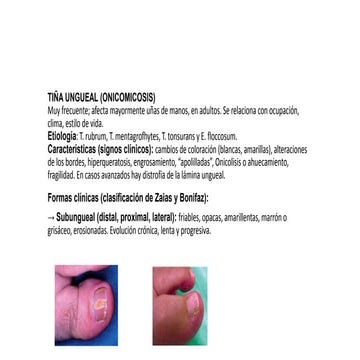 (ONICOMICOSIS).pptx
