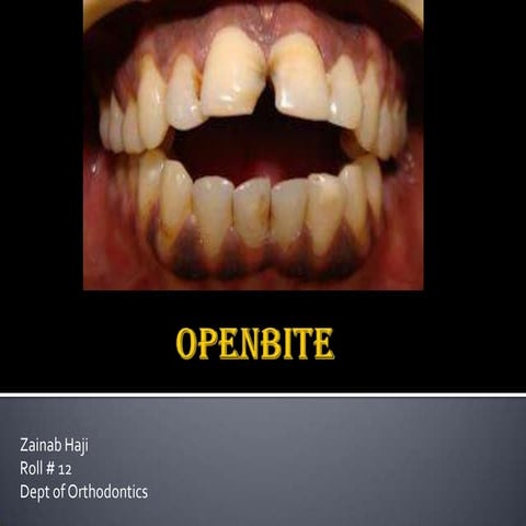 Openbite | PPTX