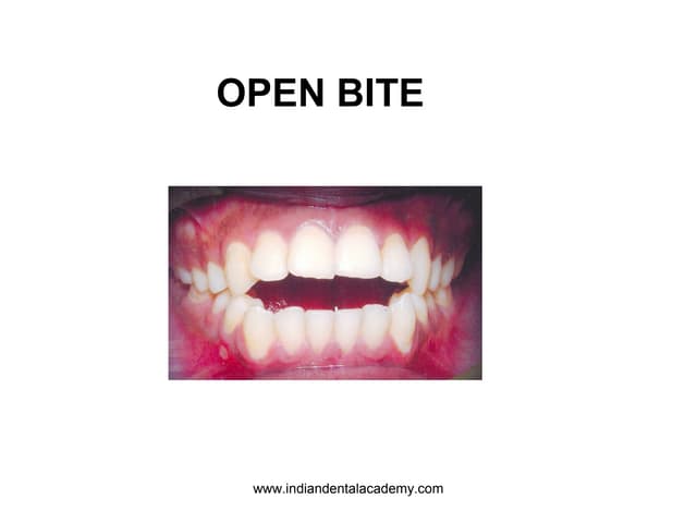 Antimicrobials and Analgesics used in Pediatric Dentistry.pptx