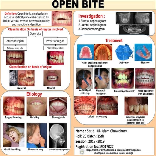 Antimicrobials and Analgesics used in Pediatric Dentistry.pptx