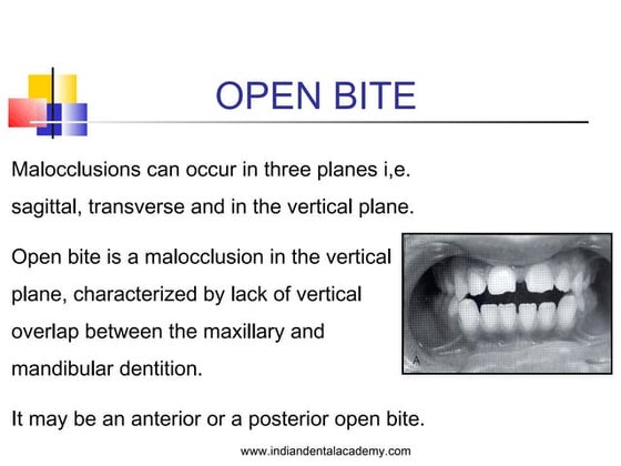 Rotation of teeth & its management | PPTX | Oral care | Personal Care