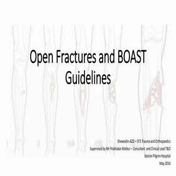 Open fractures | PPTX