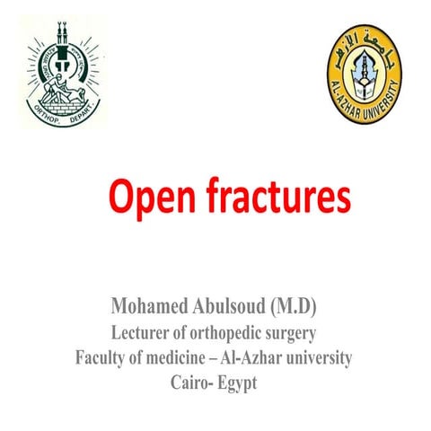 Open fractures | PPTX