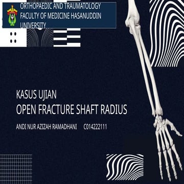 POWERPOINT Open Fracture Shaft Radius RSPTN | PPTX