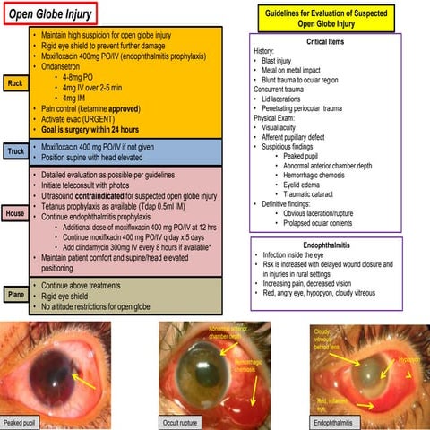 Ocular trauma ..effect on cornea and sclera