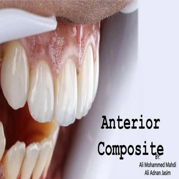 Anterior composite Dr. Ali Mohammed | PPTX