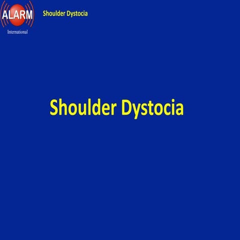 Operative Delivery Shoulderb.ppt