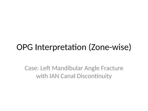 Fracture of opg interpretation of left side | PPTX