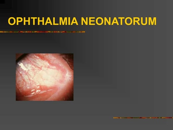 Ophthalmia Neonatorum or Neonatal Conjunctivitis | PPT