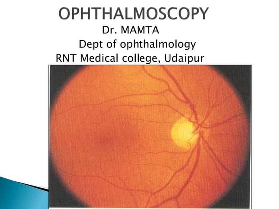 Near point of convergence | PPTX | Eye and Vision Conditions | Diseases ...