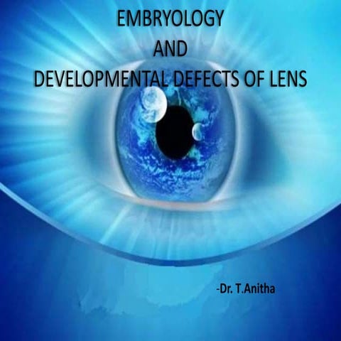 Embryology and developmental defects of lens | PPTX