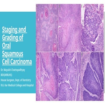 Staging and Grading of Oral Squamous Cell Carcinoma | PPTX