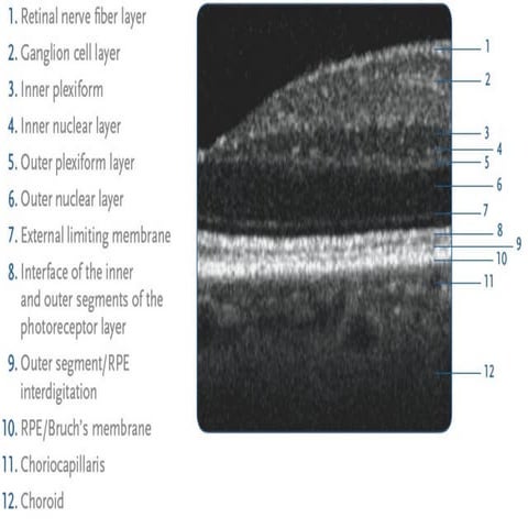 Optical Coherence Tomography - retinal layers.pptx