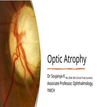 Optic atrophy.pptxbbbbbbnnnnnnnnnnnnnnnnnnnm | PPTX