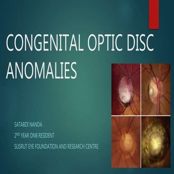Optic disc evaluation | PPTX