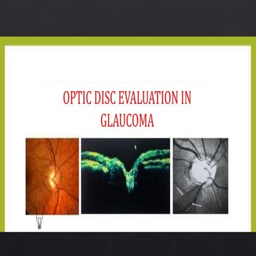 optic disc evaluation in glaucoma.pptx