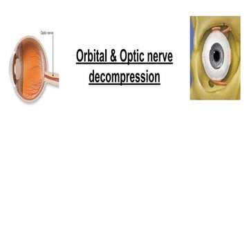Optic nerve decompression with optic nerve.pdf