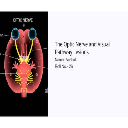 OPTIC NERVE & VISUAL PATHWAY | PPTX