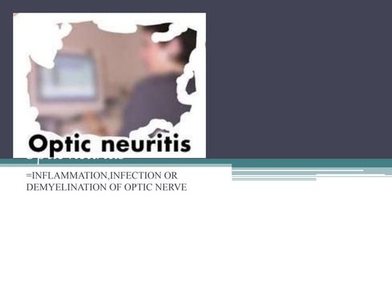 Optic Neuritis .pptx