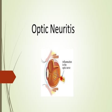 Optic Neuritis .pptx