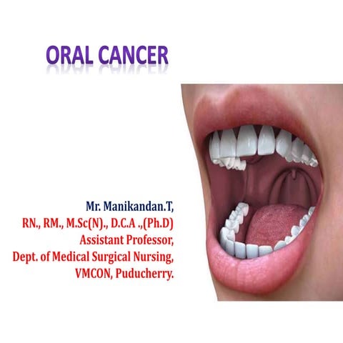 Oral cancer | PPTX
