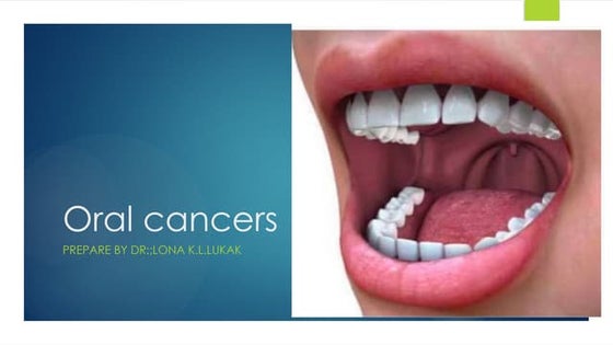 Oral cancer | PPTX | Cancer | Diseases and Conditions