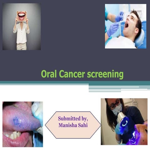 Oral cancer screening | PPTX