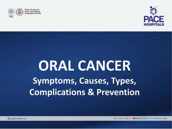Oral cancer - definition, causes, risks, symptoms, diagnosis and ...