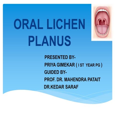 Oral lichen planus seminar | PPTX