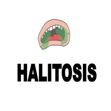 Oral Malodor.pptx zbznxjxjjsjsbbzhdhbxhxjjjx | PPT