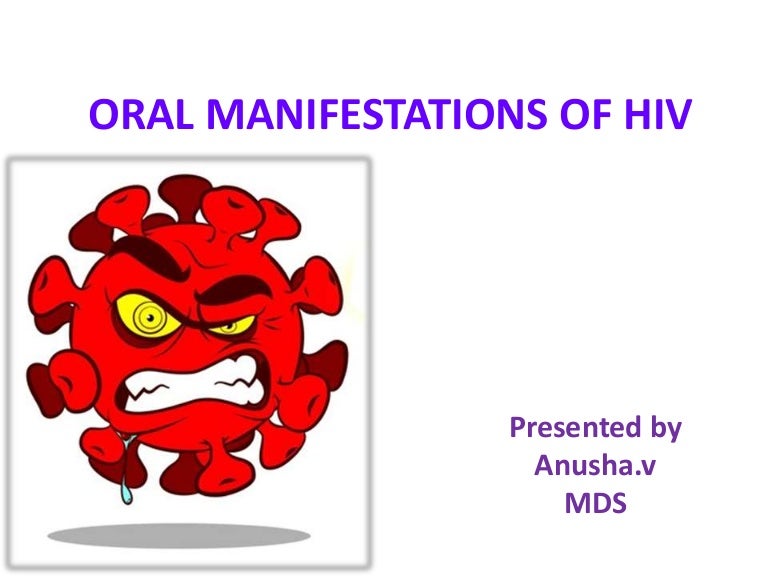 Oral manifestations of hiv/ aids